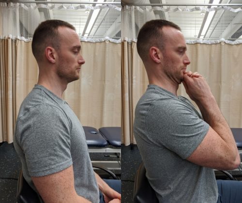 Cervical Retractions - Chiropractor in Wheaton, IL | Call (630) 510-0080